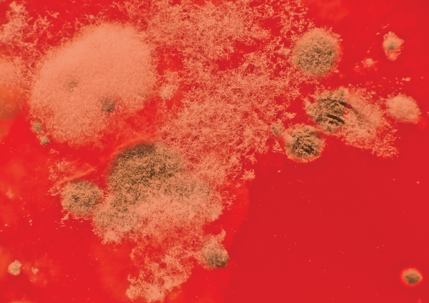 Candida and candidiasis - Fungal Infection Trust